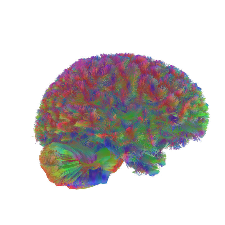 Five newly discovered life stages of your brain include a prolonged ...