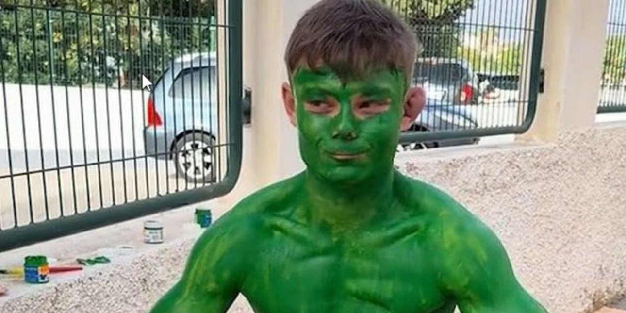 Μεταμφιέστηκε σε Hulk: Οι έξι στρώσεις πράσινης μπογιάς που δεν φεύγουν ...