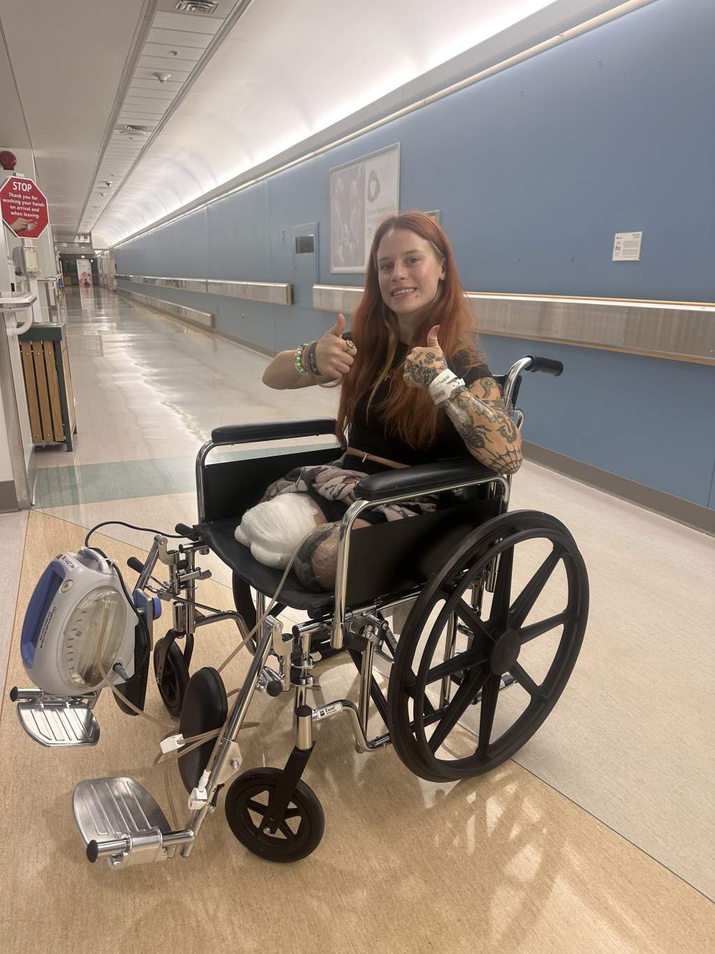 Edmonton woman, 23, adapting after collision severs legs: ‘Just ...