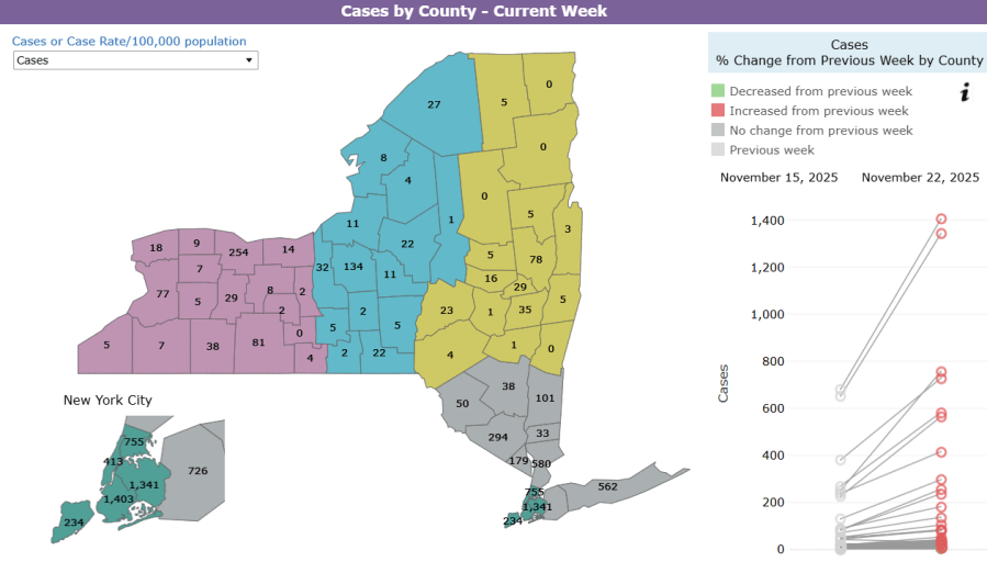 Flu cases starting to spike in Monroe County and across NY