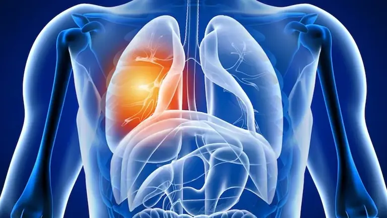 How Poor Sleep Affects Your Lungs: Expert Explains Hidden Respiratory ...