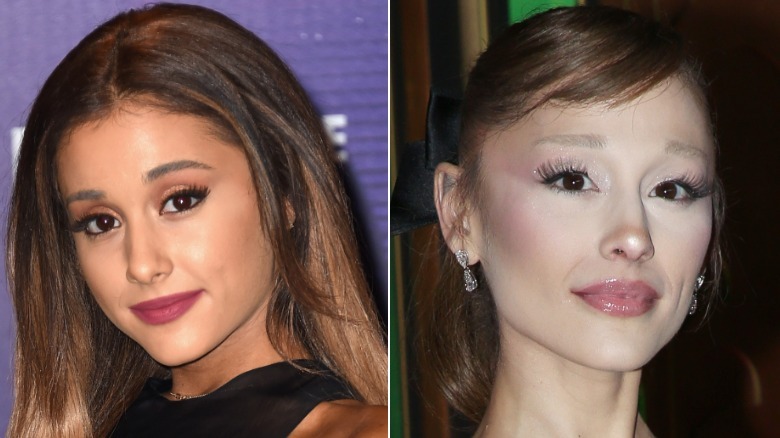 Before & After Photos Of Ariana Grande's Face Transformation Are Beyond ...