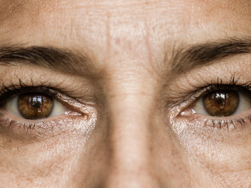 Nur 11 Euro! Dieses Produkt hilft sofort gegen dunkle Augenringe