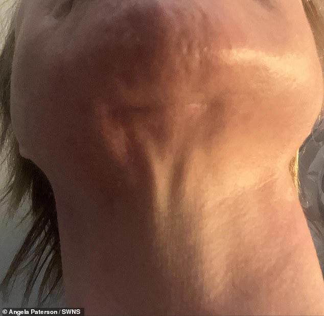 Businesswoman who flew to Lithuania for £7k surgery was left 'with ...