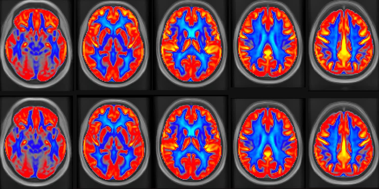 This common snack enhanced memory and brain vascular function in a 16 ...