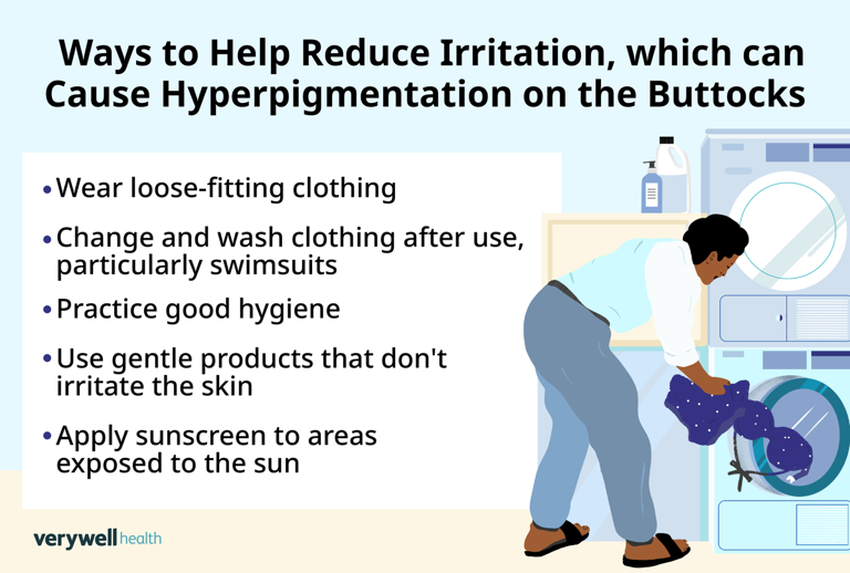 Hyperpigmentation on the buttocks: What it is and how to get rid of it