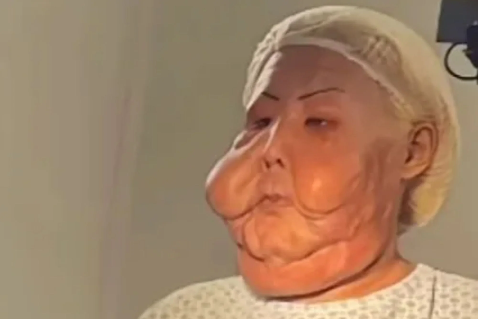 Juju do Pix inicia jornada para recuperar aparência original. Veja o ...