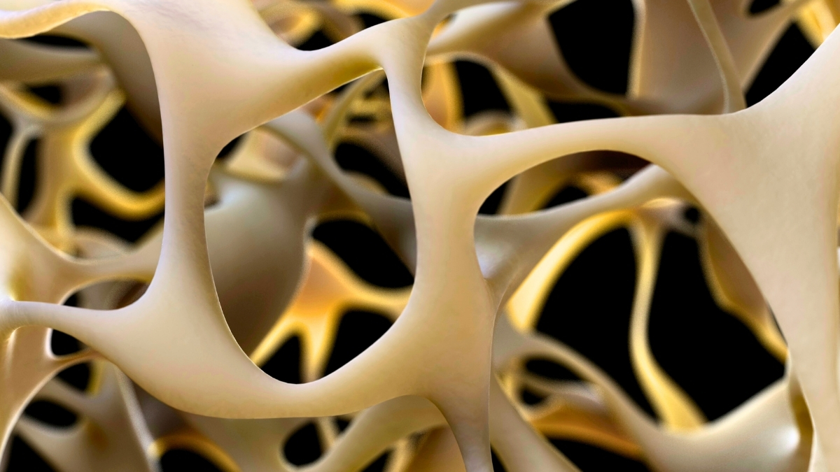 New Breakthrough to Strengthen Bone Could Reverse Osteoporosis