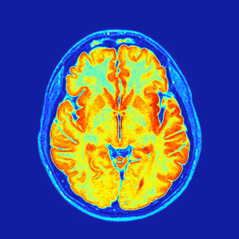 Seeing and feeling merge in the brain to shape perception