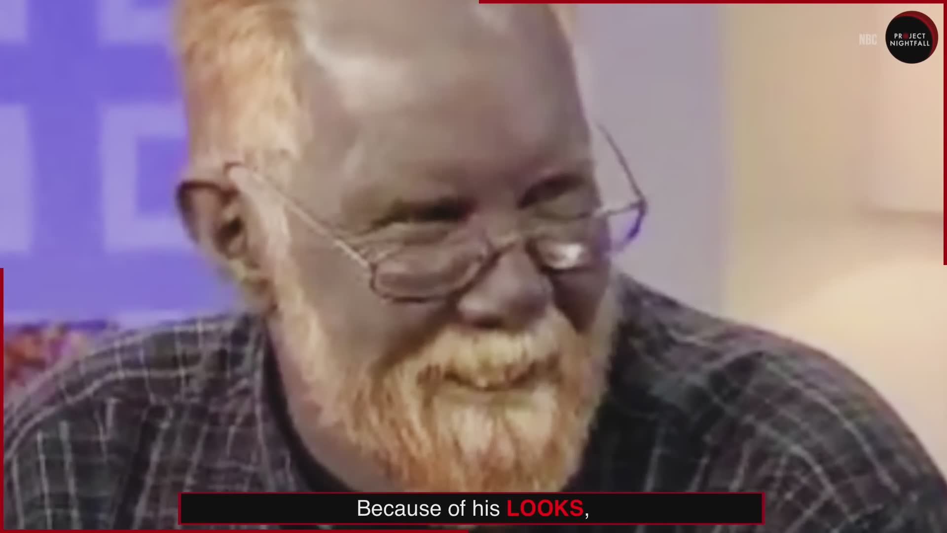 Man's skin permanently turned blue after consuming silver solution