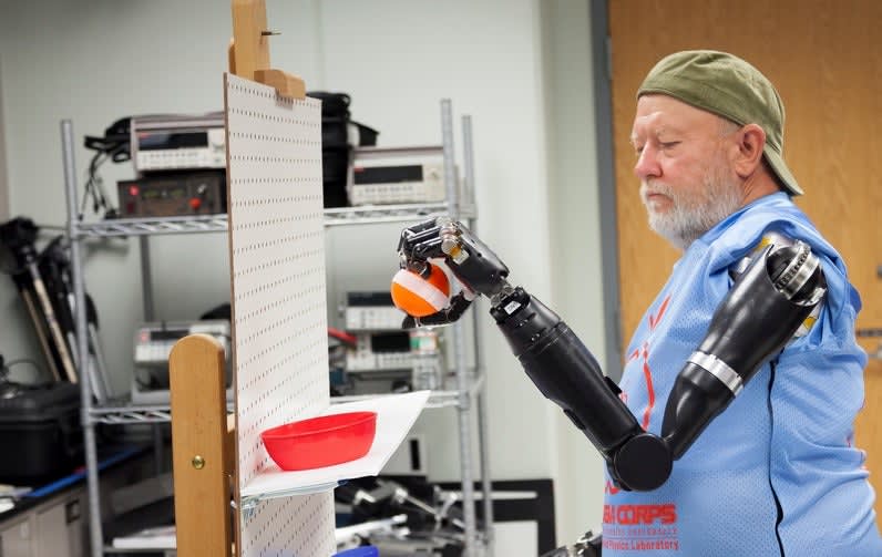 Next-gen bionic arms read nerve signals years after amputation