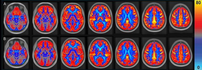 The common snack that helped enhance memory and brain function