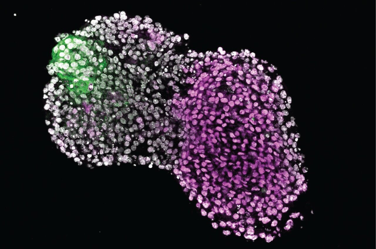 Stem cell organoids mimic aspects of early limb development