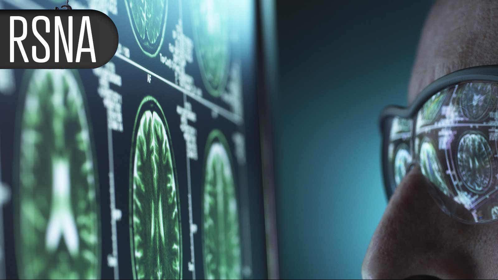 AI Model Outperformed Density Assessment in Stratifying Breast Cancer Risk