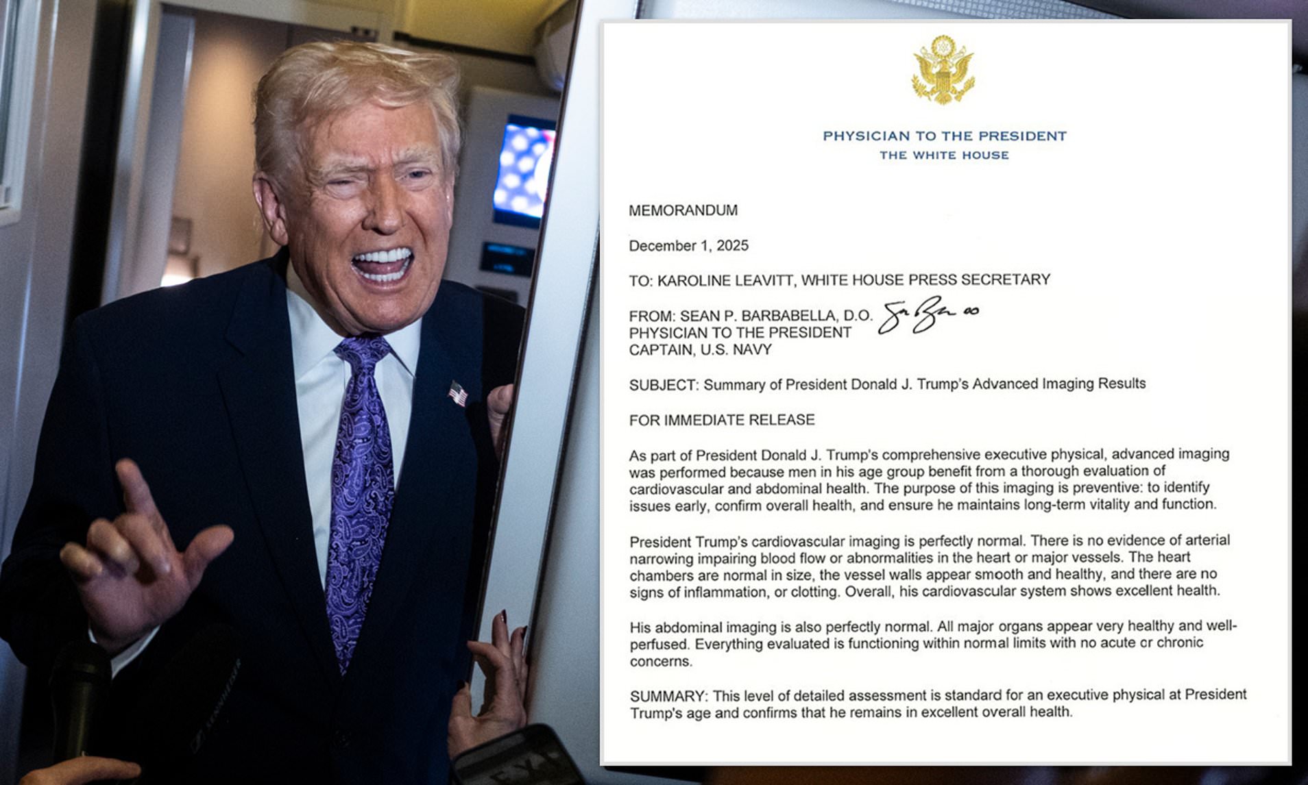 Trump's MRI scan results released by White House