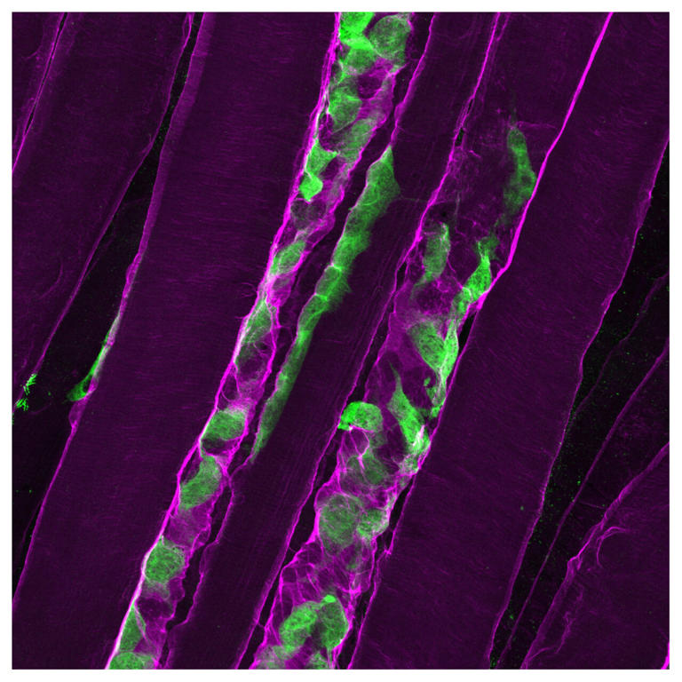 Muscle regeneration hindered by missing protein in rare muscular ...
