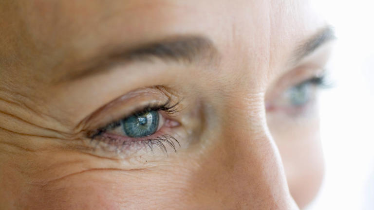 What are the early signs of cataracts? Eye surgeon reveals symptoms go ...