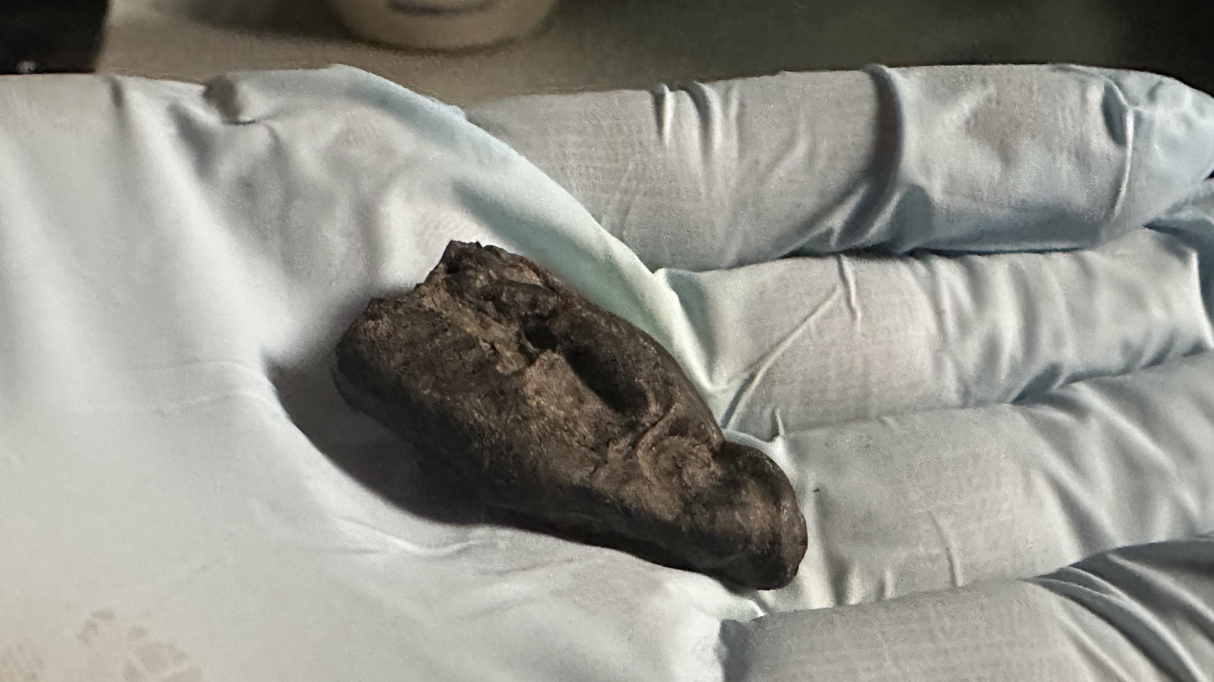 Ancient DNA Reveals That a Teenage Girl Chewed on This Wad of 'Gum ...