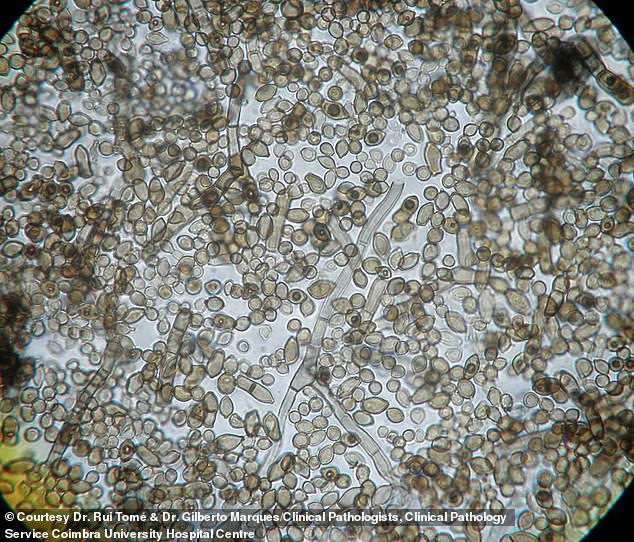 Species in Chernobyl disaster zone is mutating to feed on nuclear radiation