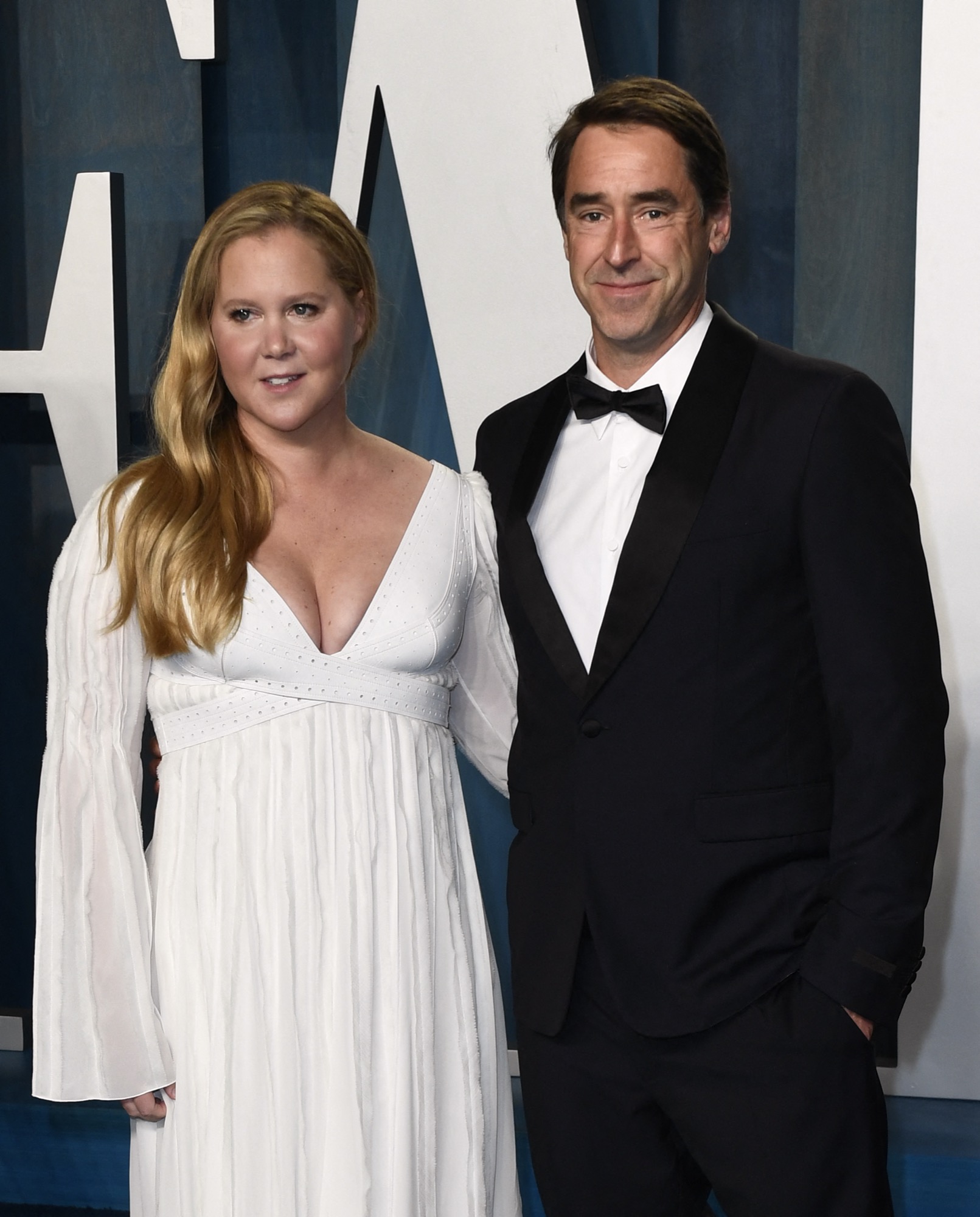 Amy Schumer Seemingly Ditches Wedding Ring in Photo Flaunting Weight Loss