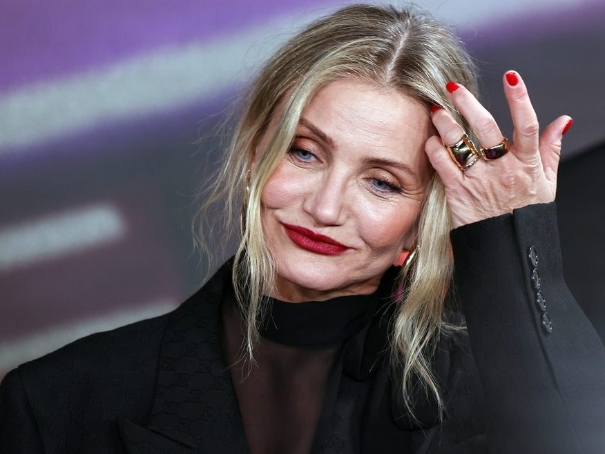 Η Cameron Diaz αποκαλύπτει την τραυματική εμπειρία της όταν έκανε botox