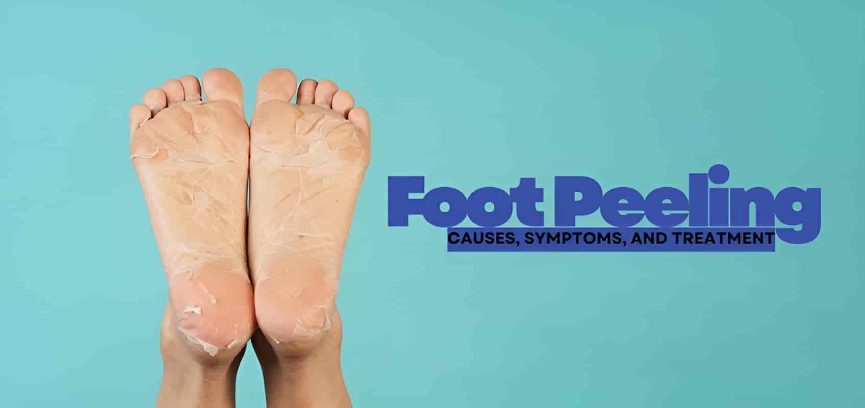 Foot Skin Peeling: Hidden Triggers And Simple At-Home Solutions