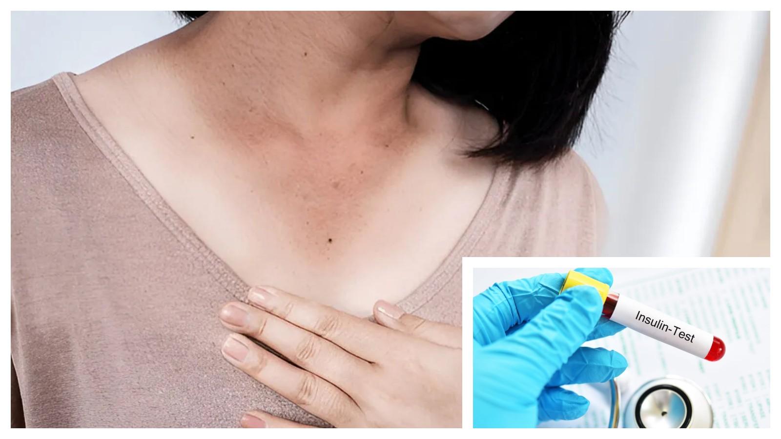 Dark patches on your child’s neck? Doctor says it may be a sign of ...
