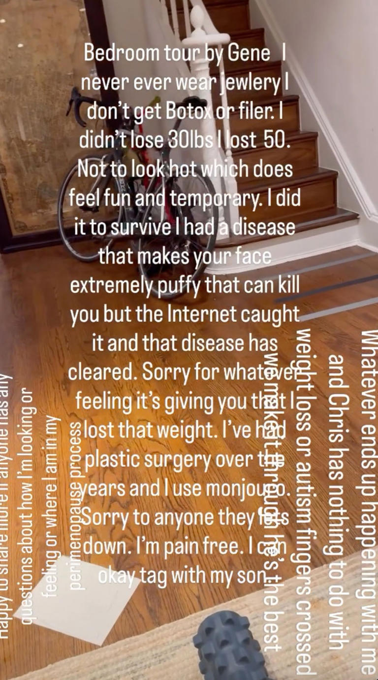 Amy Schumer sets the record straight on losing 50 pounds to ‘survive ...