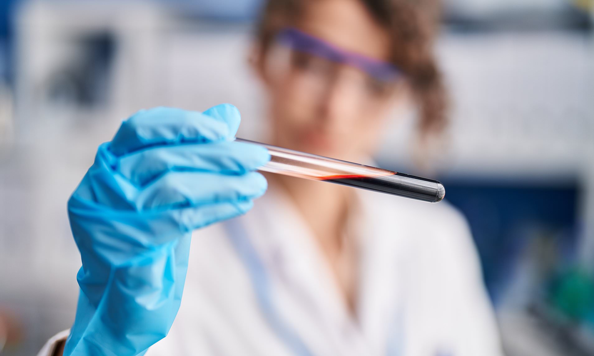 Study highlights concerning new link between obesity and Alzheimer's