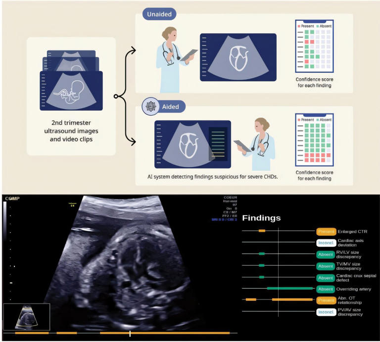 Obstetricians in NYC first to use FDA-approved AI tool that enhances ...