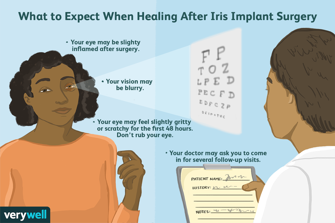 Can you really change your eye color?