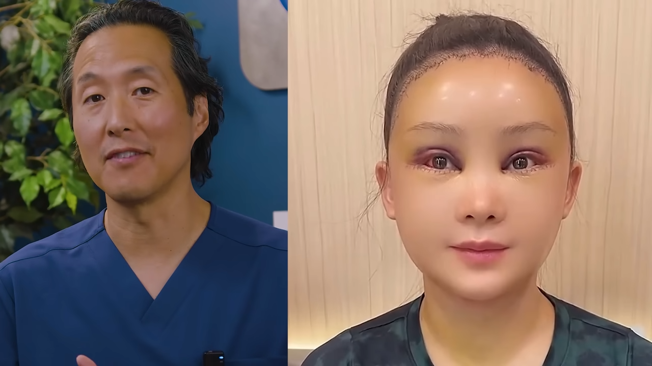 Reaction to extreme cosmetic surgery