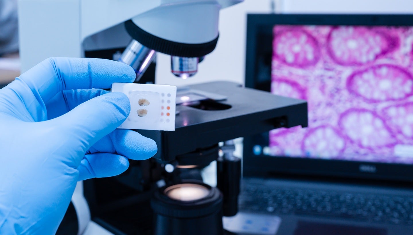 Inductive Bio gains $21m ARPA-H funds for drug prediction models