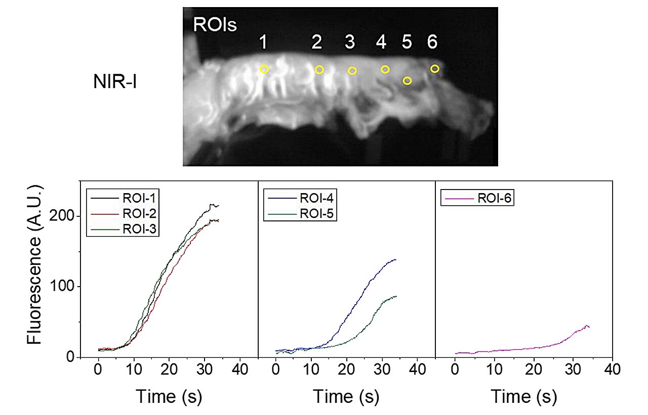 For the first time, next-gen infrared fluorescence imaging helps ...