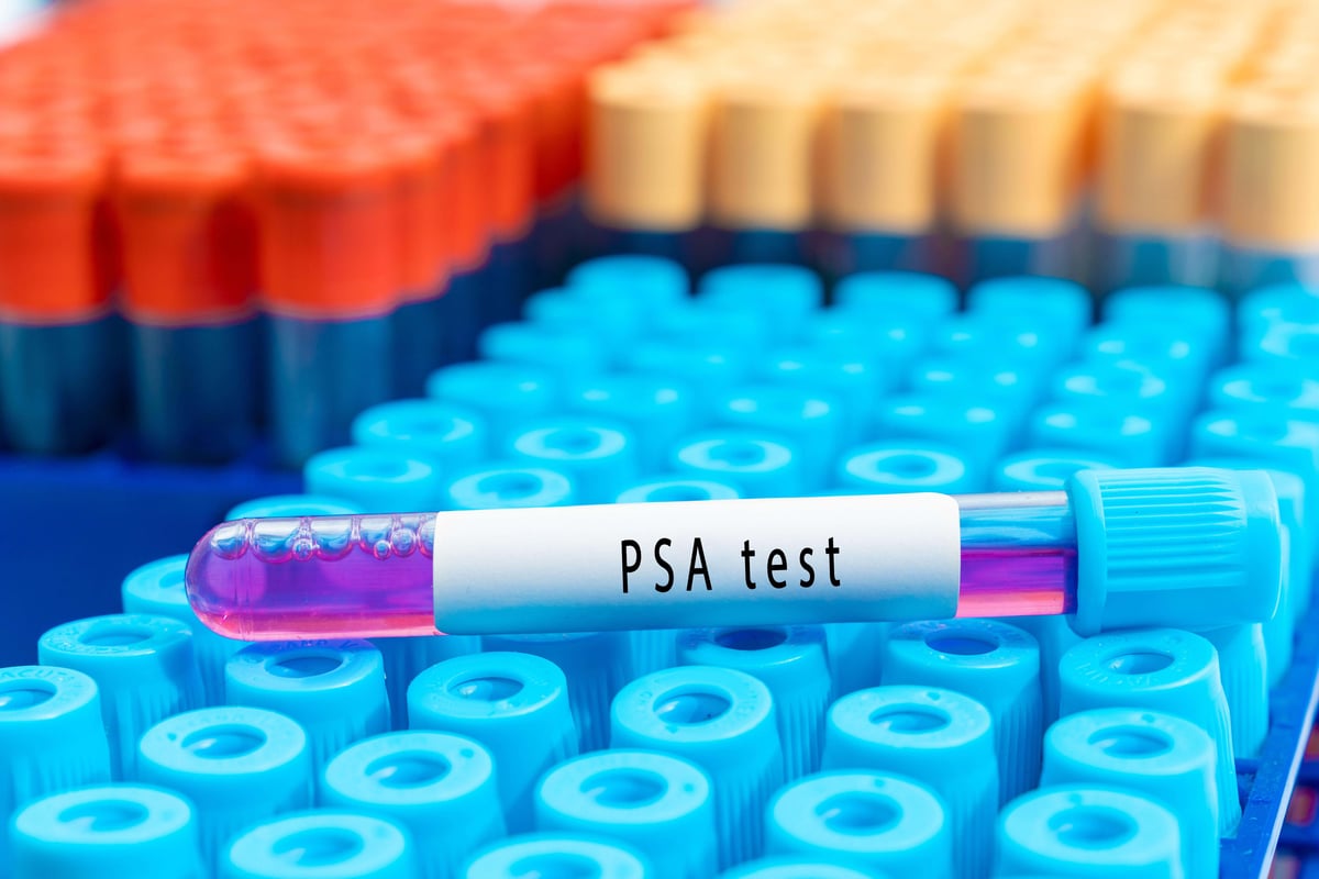 Ads for 'misleading' prostate supplements and home testing kits banned