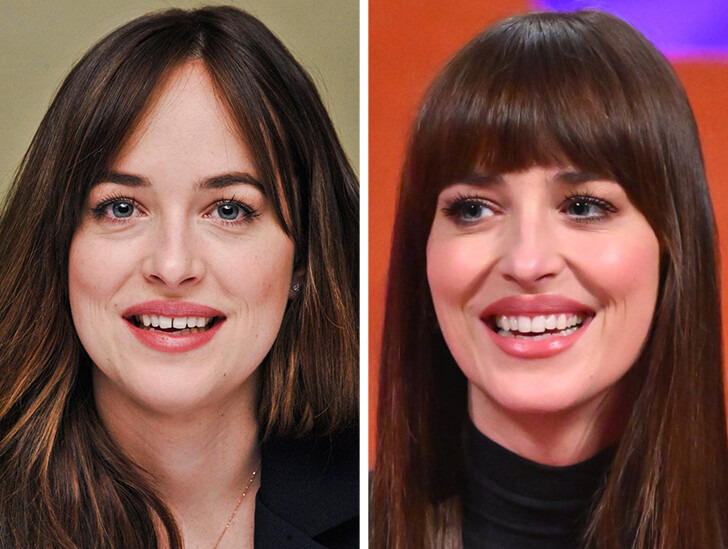 14 celebrities who prove that teeth makeovers can completely redefine ...