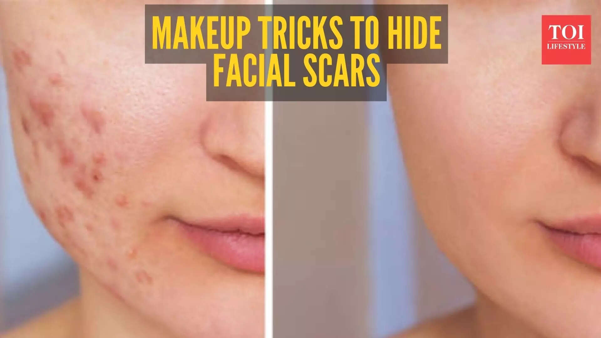 How to hide facial scars with makeup