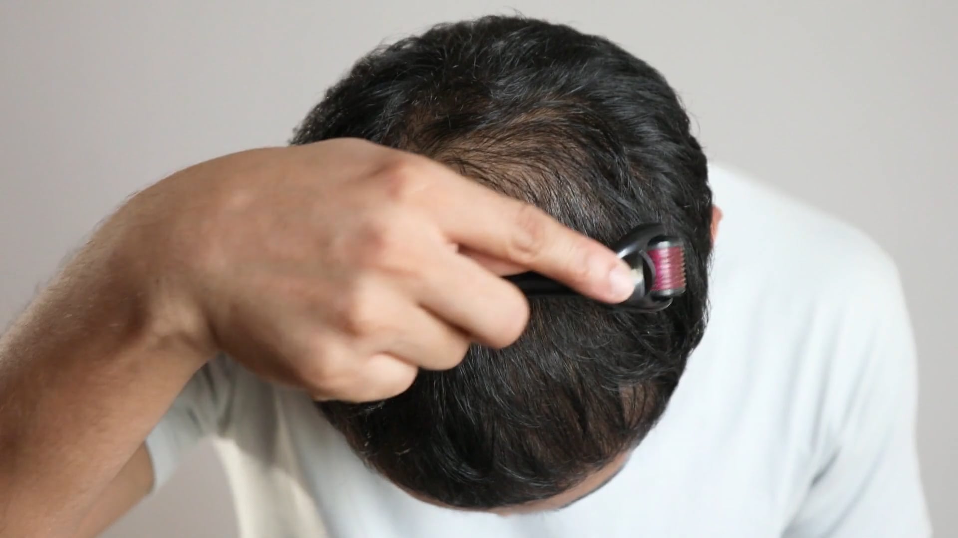 Hair loss treatment gets major upgrade using natural plant-based sweetener