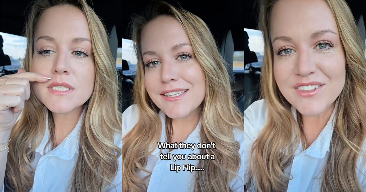 A TikTokker Said Her Botox “Lip Flip” Had An Unexpected Side Effect