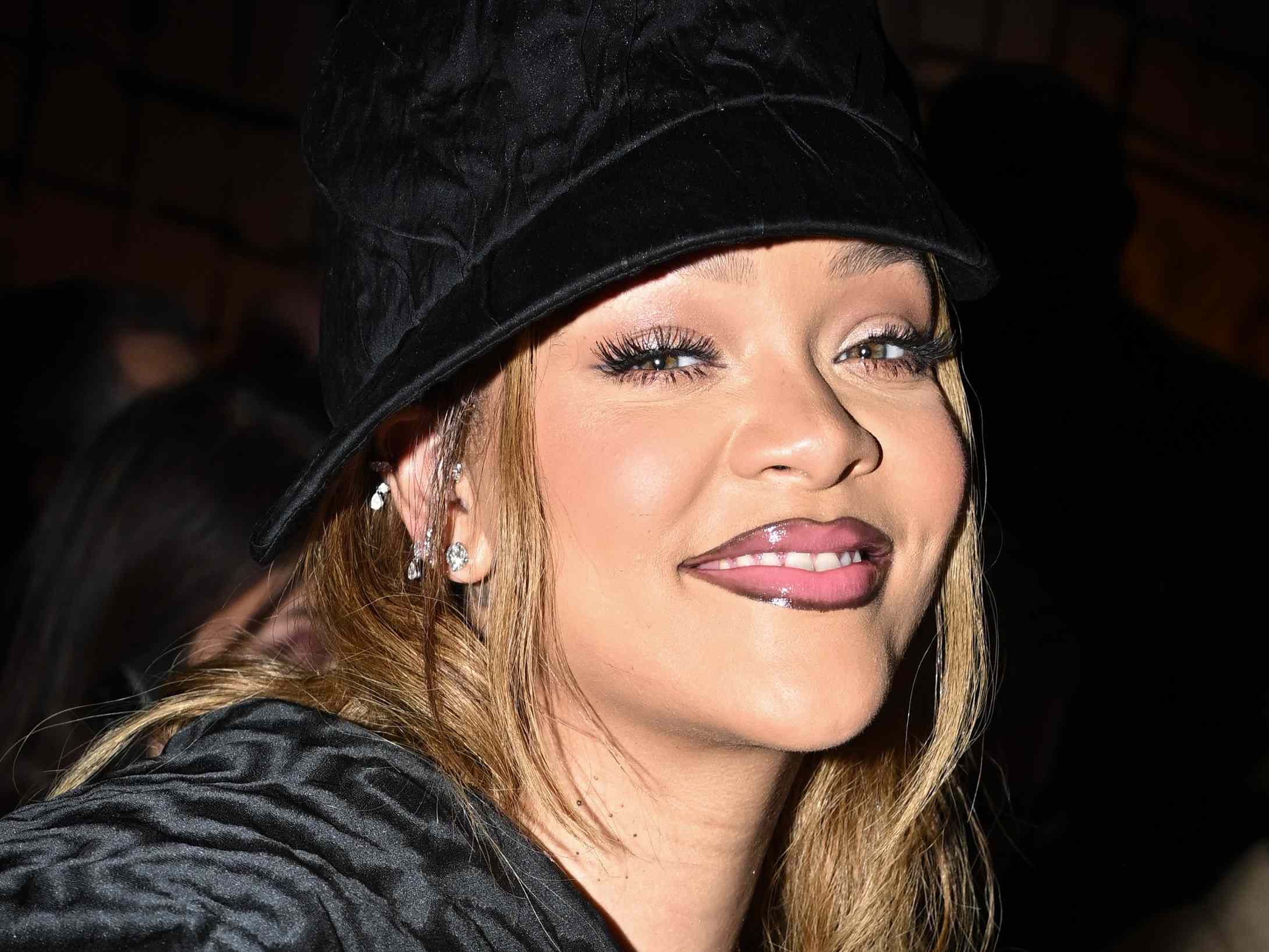 Plastic surgeons reveal the most in-demand lip shapes