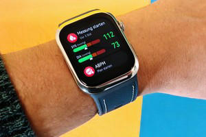 Top 10: Die beste Smartwatch mit EKG im Test – Vorhofflimmern erkennen