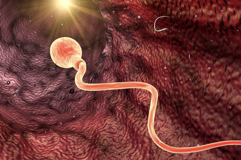 Sperm donor with 'cancer causing gene' helped conceive nearly 200 children