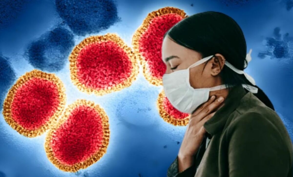 ¿Qué es la gripe H3N2? Conoce síntomas, grupos vulnerables y riesgo