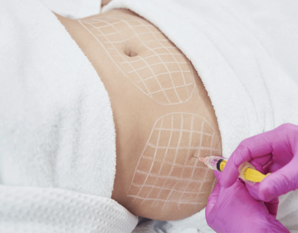 Fat dissolving training – inspiring aesthetic professionals with ...