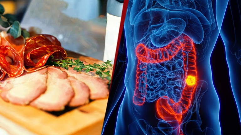 The red meat cancer scare is misleading. Here's what science actually shows