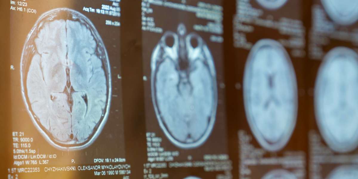 Neurologists say these 8 warning signs should never be ignored