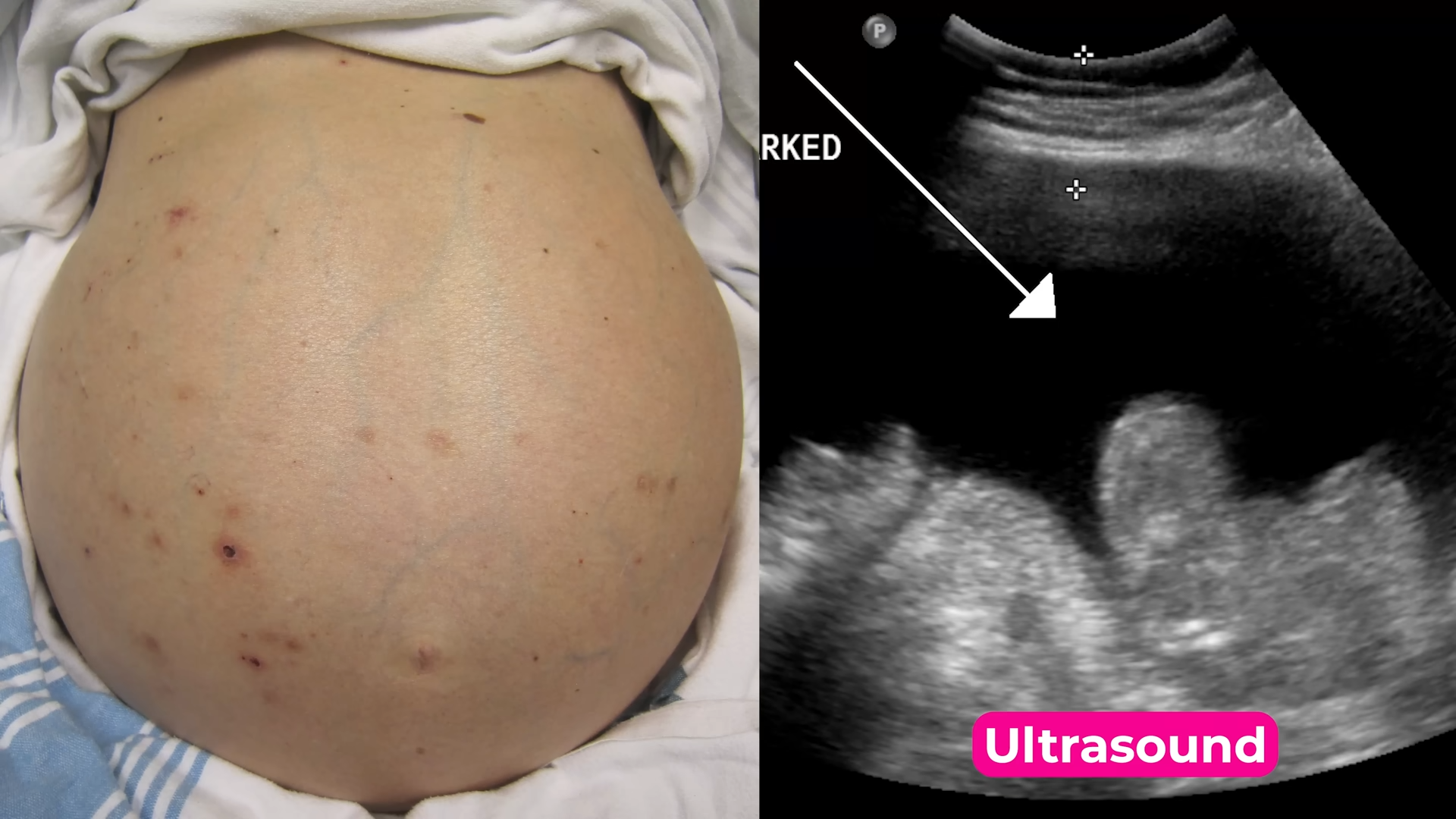 Inside a doctor’s day treating liver disease and hypertensive emergency