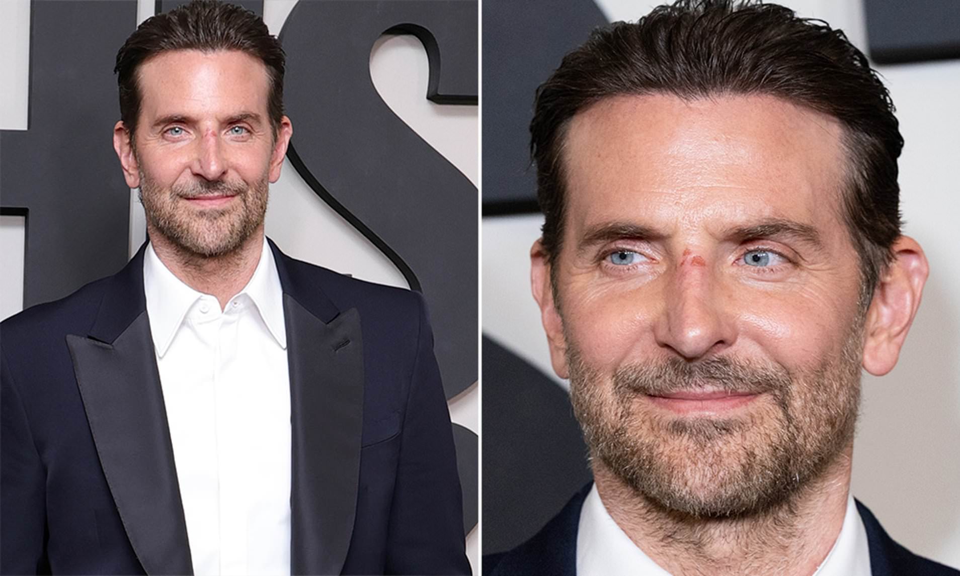 Bradley Cooper sports a grazed nose as he hits the red carpet at Is ...