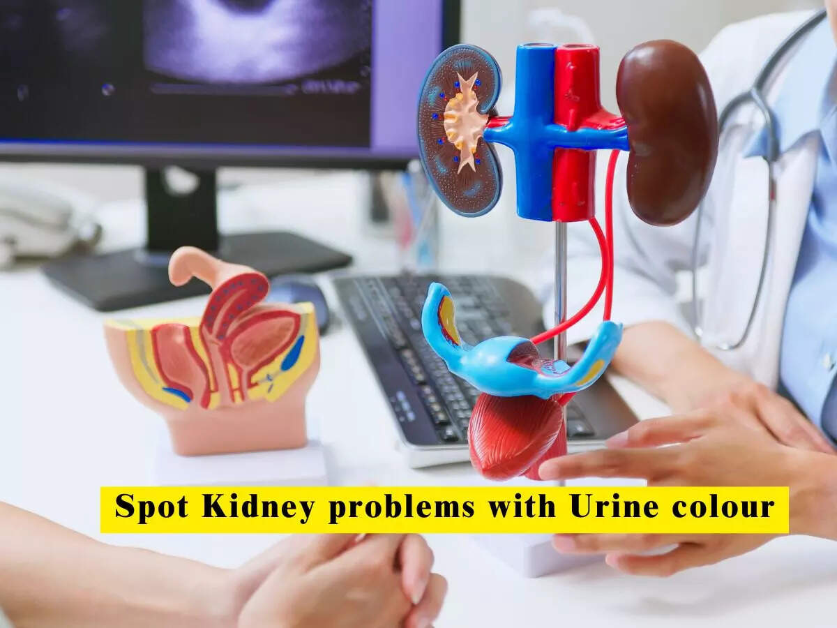 Urologist explains how to spot kidney problems early by checking urine ...