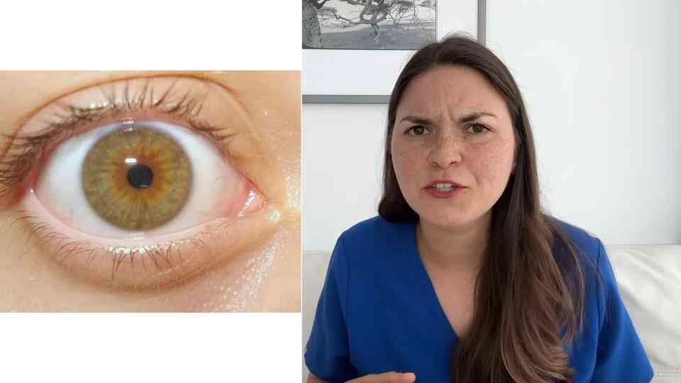The silent health warnings visible in your eyes